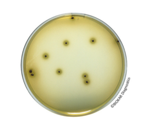 Products - BIOKAR Diagnostics