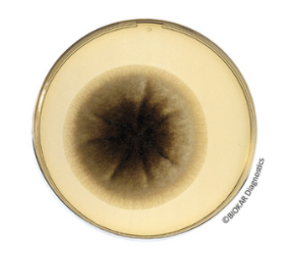 Oxytetracycline Glucose Agar (OGA) - BIOKAR Diagnostics