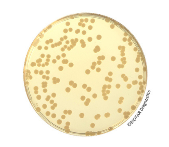 Trypto-Casein Soy Agar (TSA) - BIOKAR Diagnostics